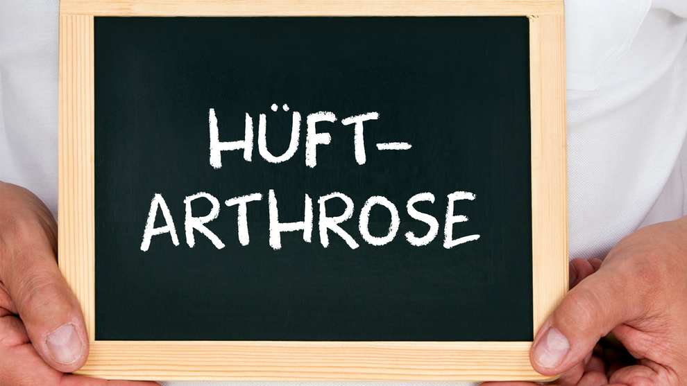Hüftarthrose | Arthrose