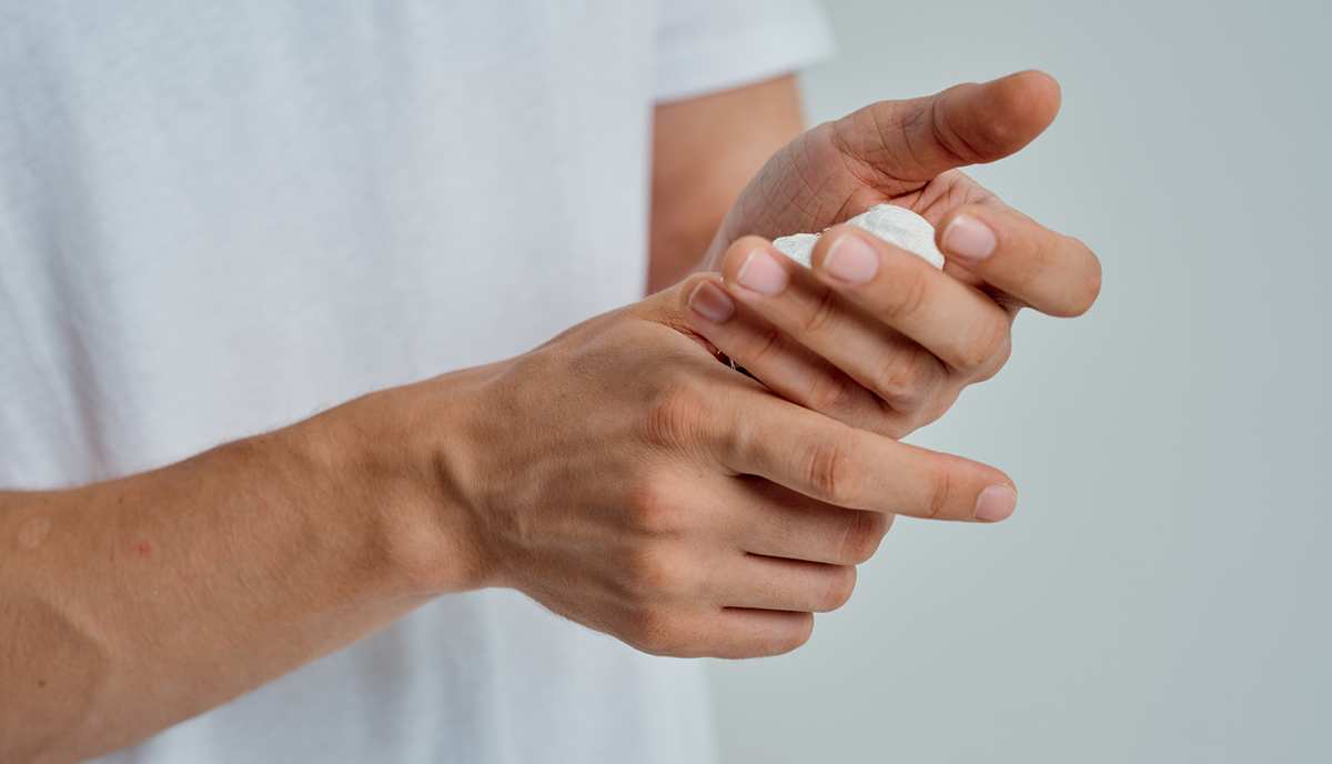 Hand– oder Finger-Prellung | Prellung